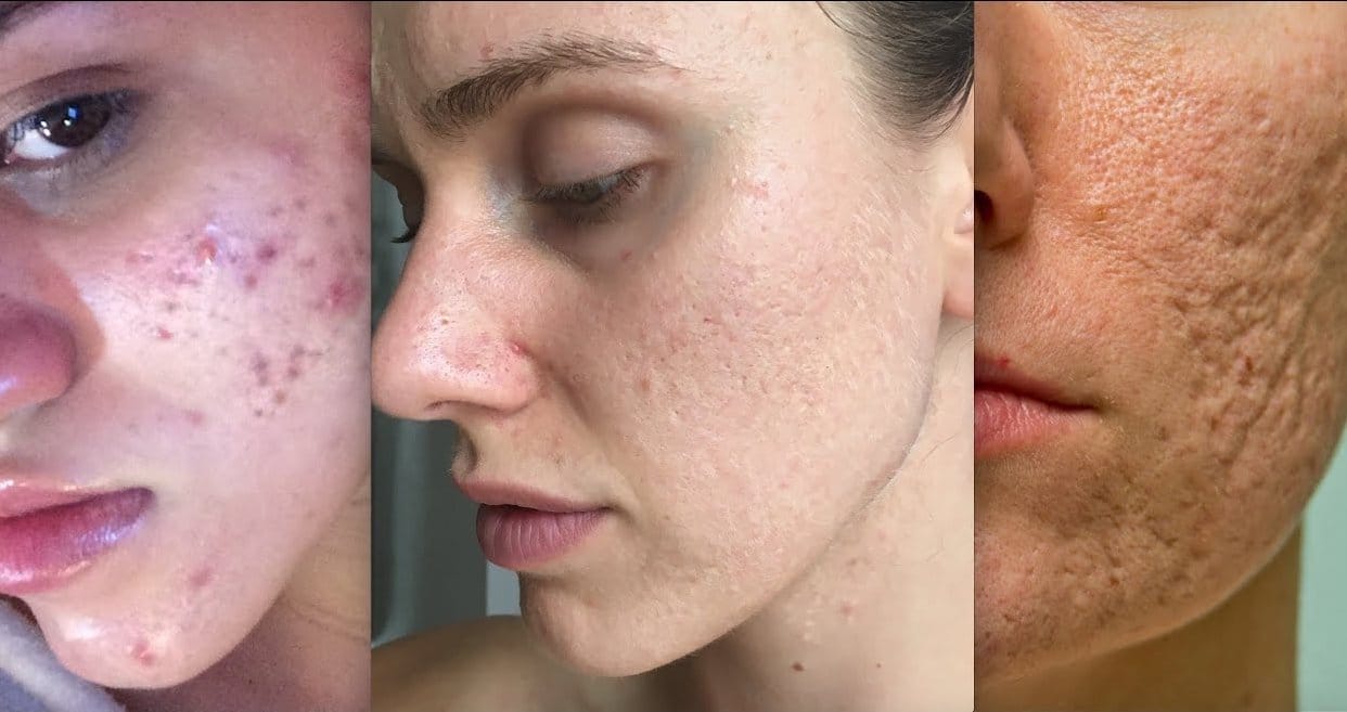 hipwee-maxresdefault-16 – Lifestyle People